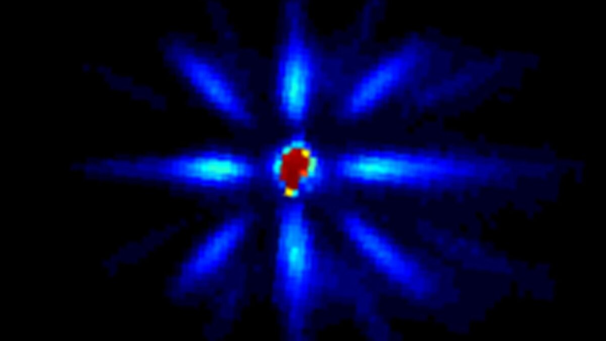 Next generation microscopy methods - Novel lensless imaging approaches